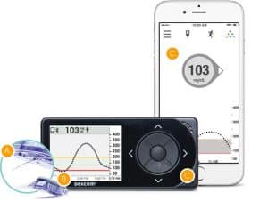 Dexcom G5 Mobile Continuous Glucose Monitoring System Review