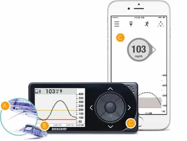 Dexcom G5 Mobile Continuous Glucose Monitoring System Review