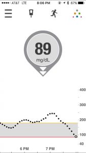 Dexcom G5 Mobile Continuous Glucose Monitoring System Review