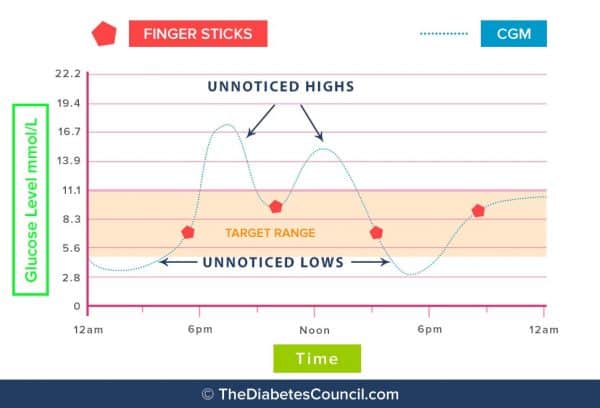 Does CGM replace finger sticks?